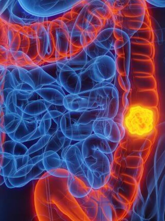 Top 8 Superfoods for Gut Health - Insights Care